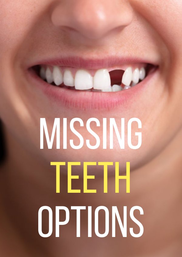 Missing Teeth Options by Dental Designs - Flipsnack