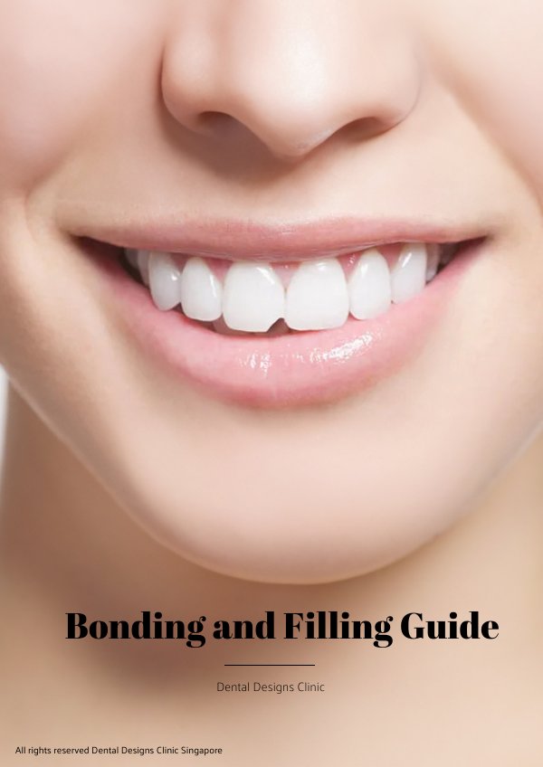 Bonding and Filling by Dental Designs - Flipsnack